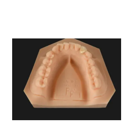 EMAX RESTORATIONS: dentallabgs