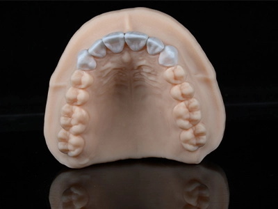 DIAGNOSTIC WAX-UP: dentallabgs